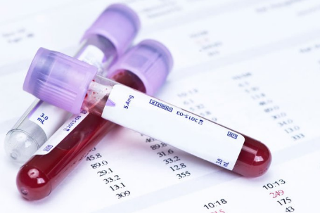 Chỉ số NEUT (Neutrophil) là gì? Ngưỡng an toàn của chỉ số NEUT