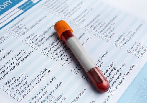 Chỉ số LYM (Lymphocyte) là gì? Những điều cần biết về chỉ số LYM